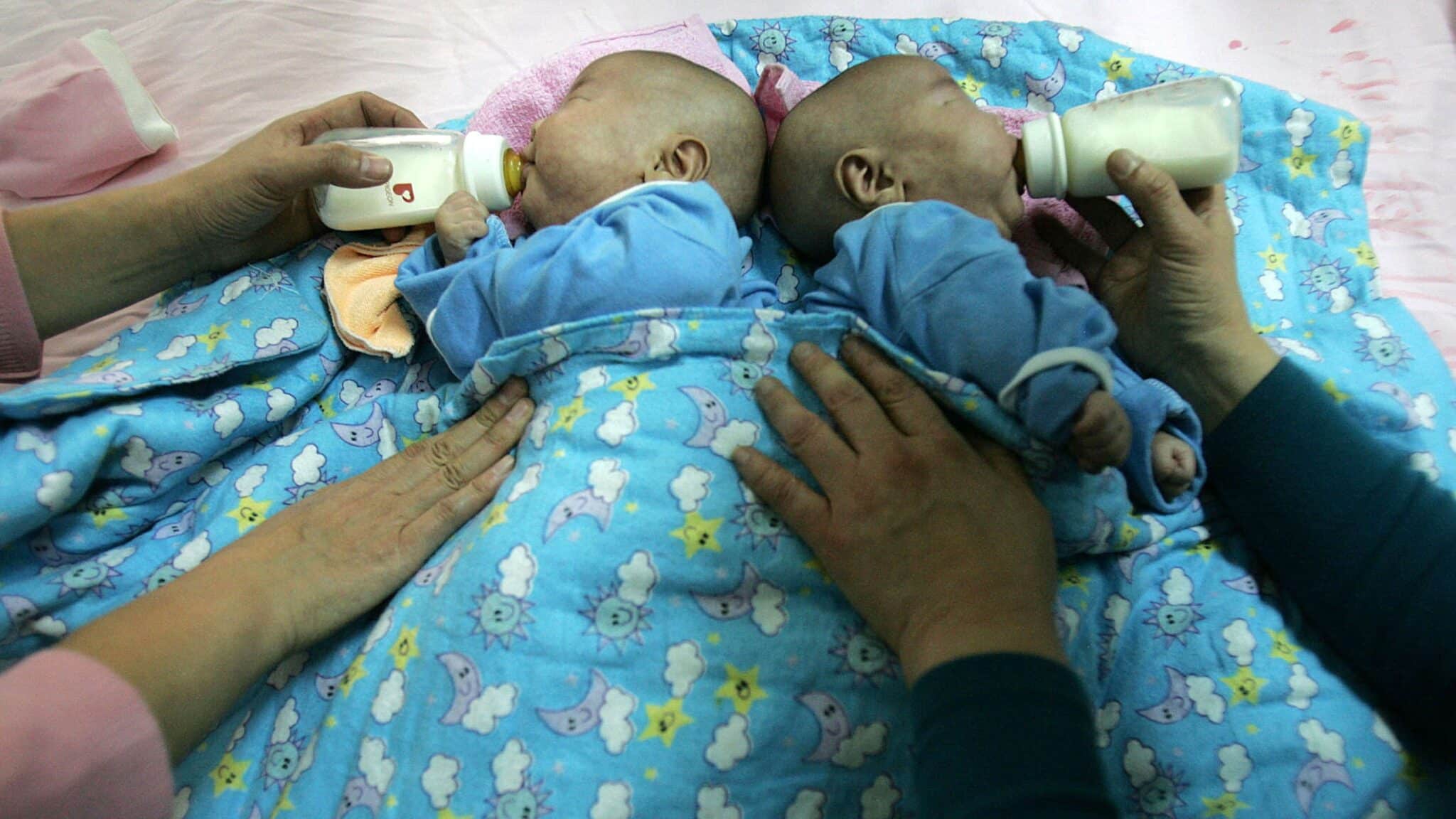 Conjoined Latinas Show Off Distinct Personalities on TikTok